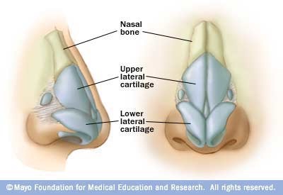 Management of Nasal Fractures